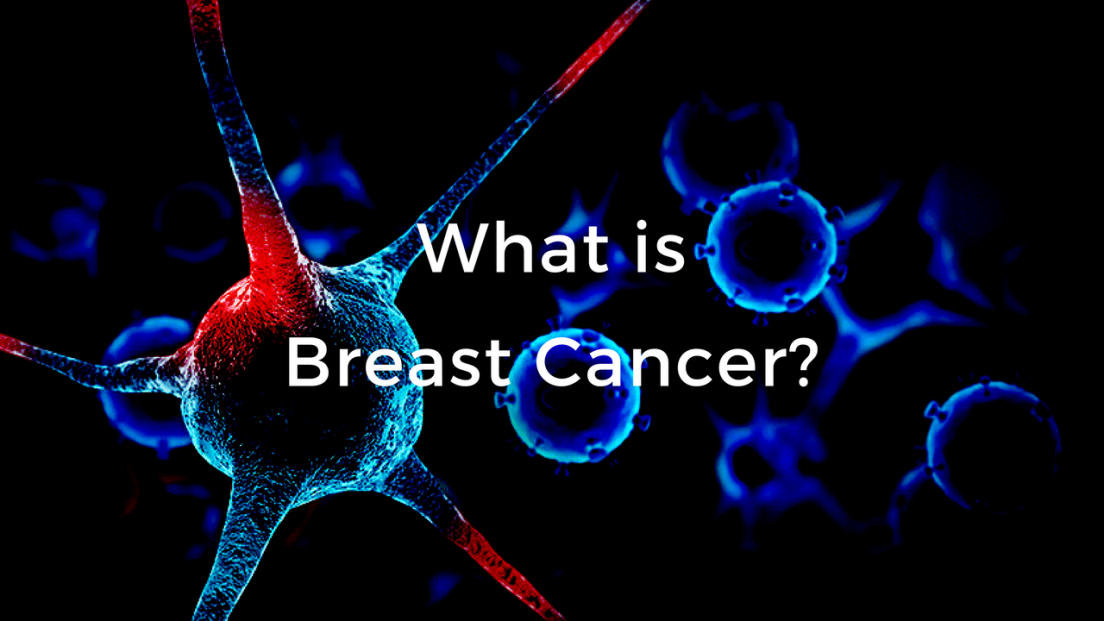 Breast Cancer Basics Video Course: Breast Cancer School for Patients